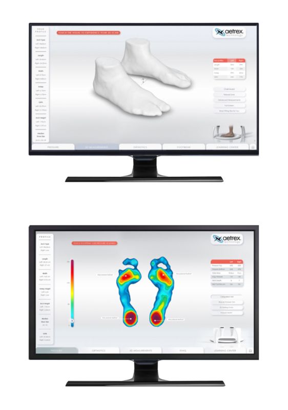 Aetrex 3-D voetscanner
